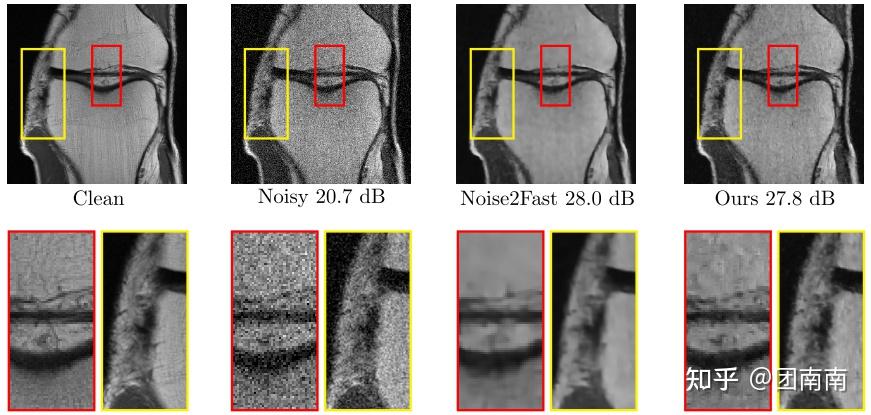 文献阅读：Zero-Shot Noise2Noise: Efficient Image Denoising without any Data - 知乎