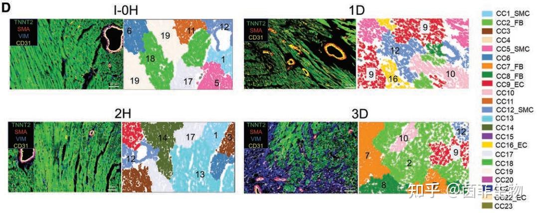 Circ Res | IMC绘制小鼠心肌缺血再灌注损伤的单细胞蛋白修饰时空图谱 - 知乎