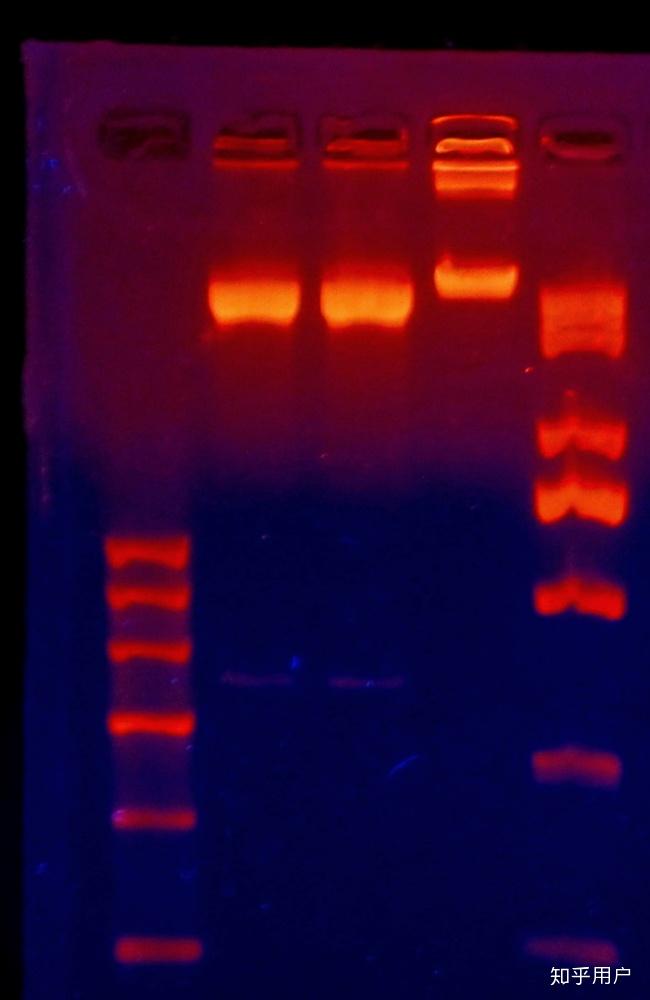 DNA检验问世之前，使用的磷酸葡萄糖转化酶(phosphoglucomutase, PGM)是什么？ - 知乎
