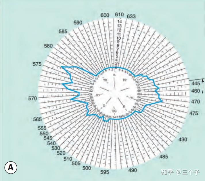 No.7,Perimetry (1) - 知乎