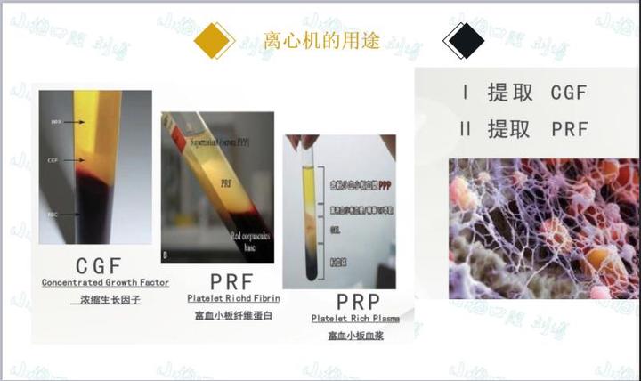 cgf与prp疗效对比 - 知乎