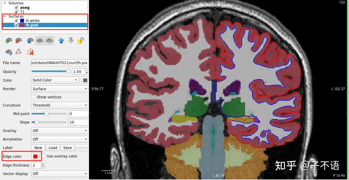 freesurfer全过程梳理 - 知乎