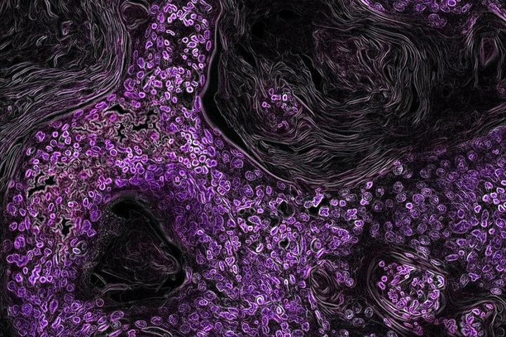 Nature：KRAS药物"救星"，找到了！ - 知乎