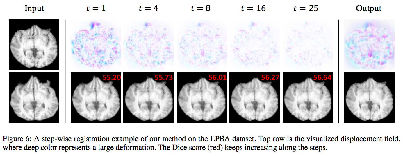 基于强化学习的图像配准 - Image Registration: Reinforcement Learning Approaches - 知乎