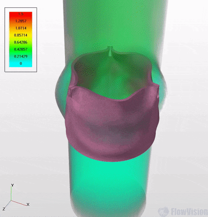FlowVision在心脑血管生物力学CFD仿真分析的应用 - 知乎