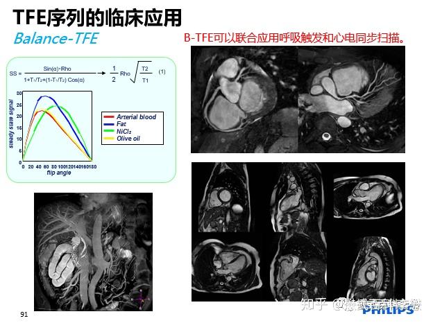 磁化准备超快速梯度回波序列 - 知乎