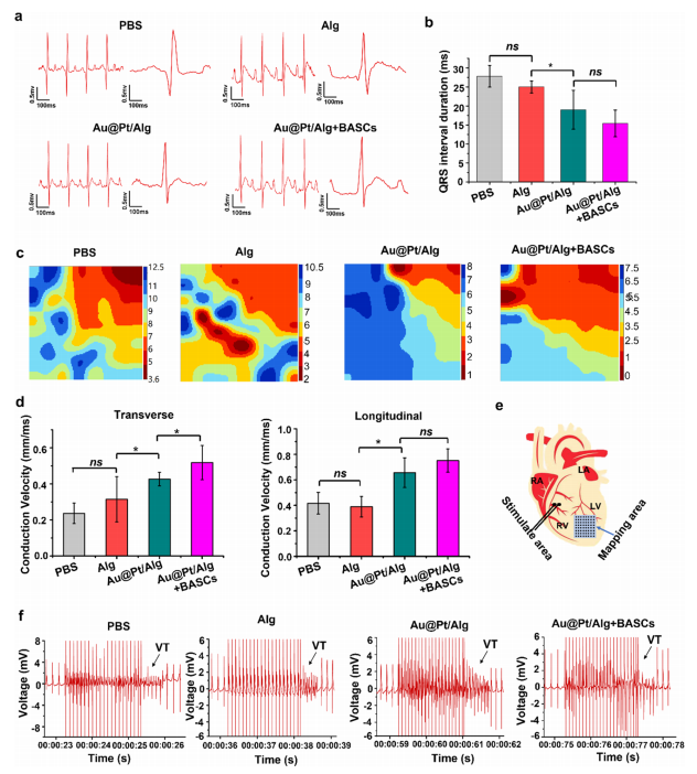 《ACS NANO》: 包裹双功能 Au@Pt 核壳纳米颗粒可注射水凝胶调节梗死微环境,并通过抗氧化和电整合提高干细胞治疗效果 - 知乎