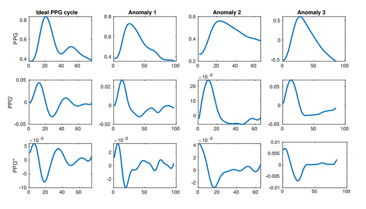 PPG信号与血压 - 知乎