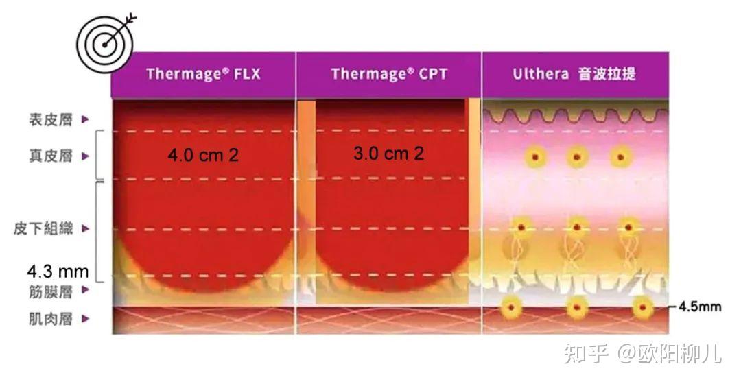 5代热玛吉FLX相比4代热玛吉CPT有哪些技术升级，在疗效上有哪些提升？ - 知乎