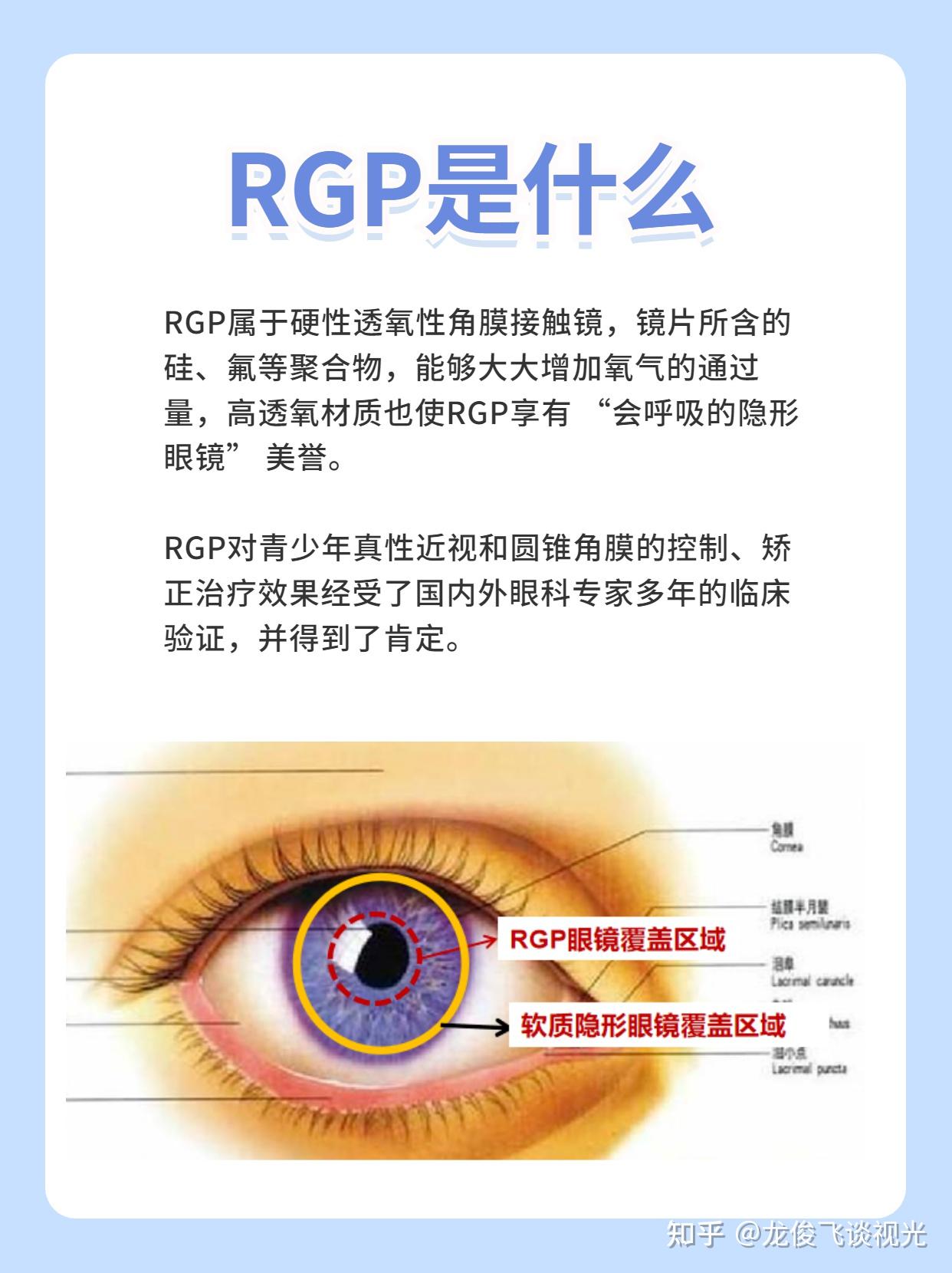 新手攻略｜RGP品牌对比，哪个性价比高 - 知乎