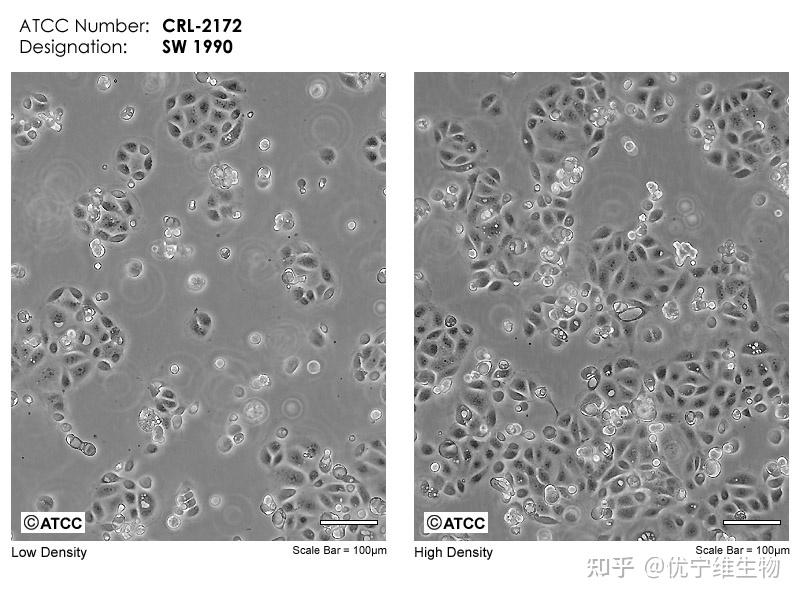 CFPAC-1、SW 1990、PANC-1、Panc02胰腺癌细胞系培养合集来袭！ - 知乎