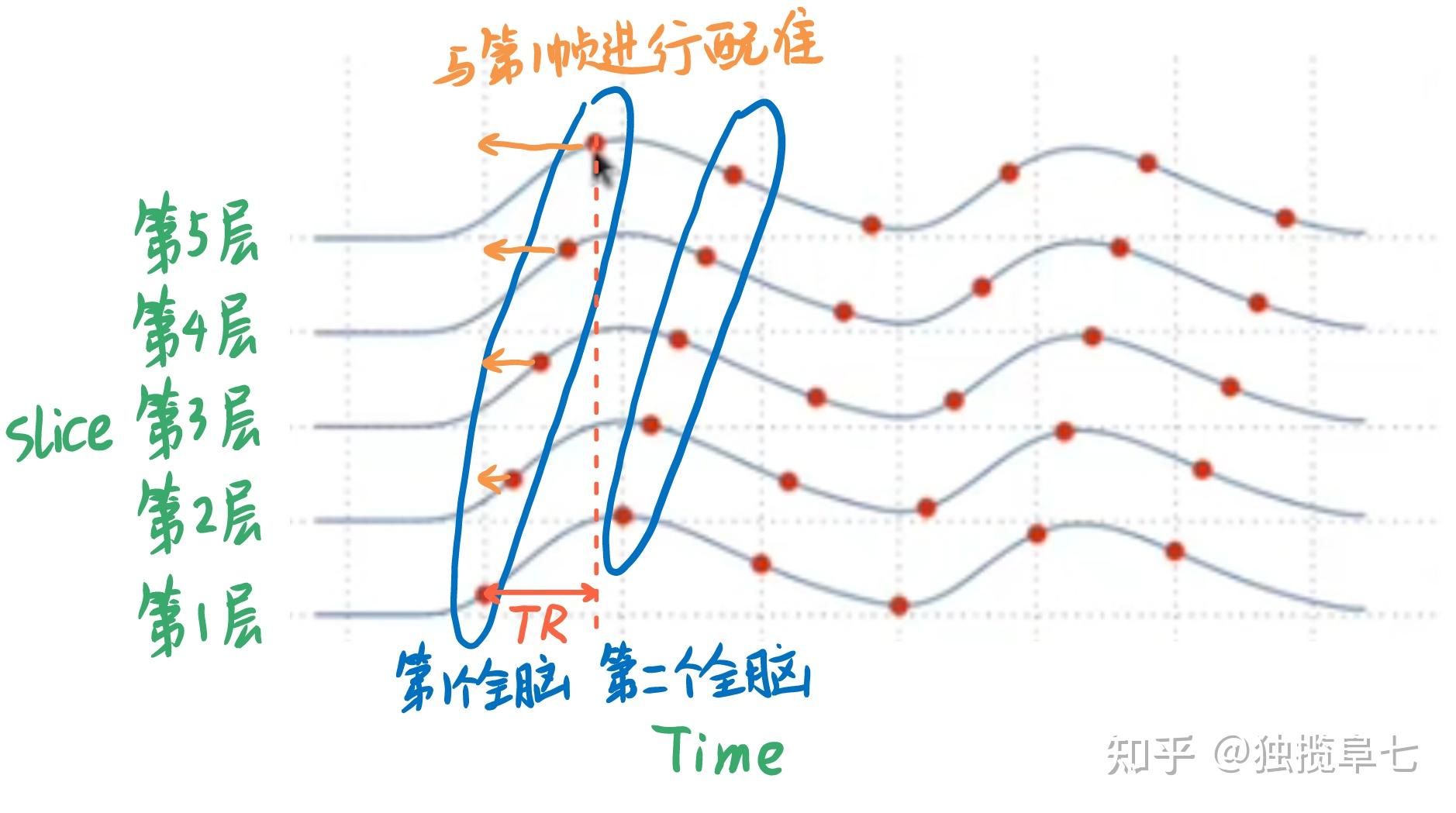 用AFNI处理fMRI数据 - 知乎