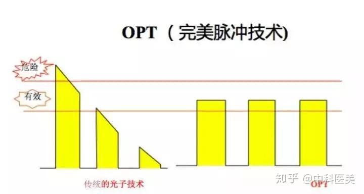 IPL、OPT、DPL是什么呢？怎么区分这些光谱？ - 知乎