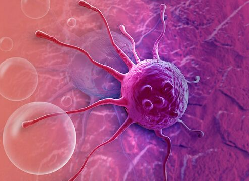 Science子刊：激光设备Cytophone可检测甚至杀死血液中的肿瘤细胞 - 知乎