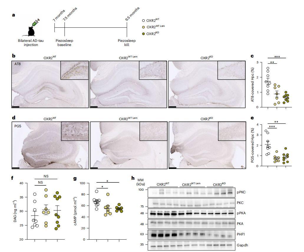 睡眠药竟能延缓阿尔茨海默病？科学家发现关键机制 - 知乎