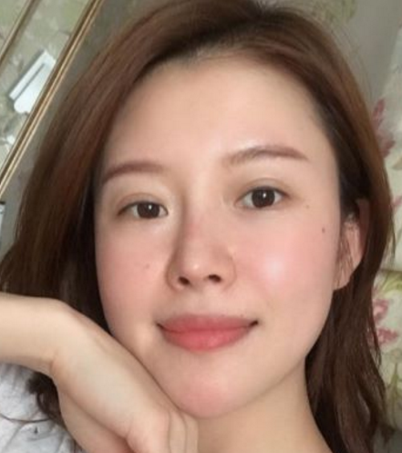 想在北京做脂肪填充，有哪些审美好，资历深的医生推荐？性价比高一点的? - 知乎