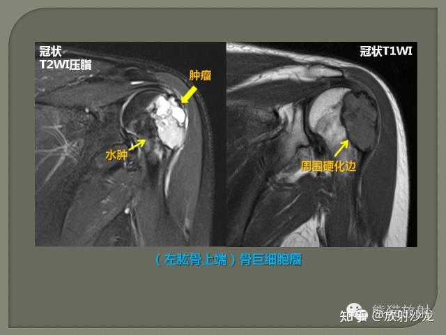 如何简单理解、认识MRI图像 - 知乎