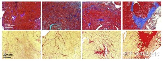 Molecular Therapy Nucleic Acids: Nlgn环状RNA介导阿霉素诱导的心脏重构和纤维化 - 知乎