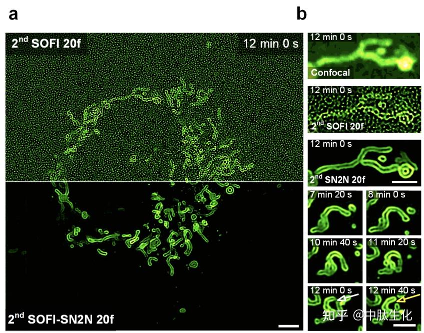 Nat Methods：赵唯淞/李浩宇/陈良怡合作发明SN2N自启发去噪方法，实现快速、温和的长时程超分辨成像 四色活细胞超分辨成像 - 知乎