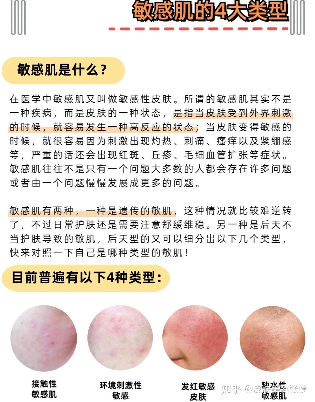 敏感肌的表现有哪些? 知乎