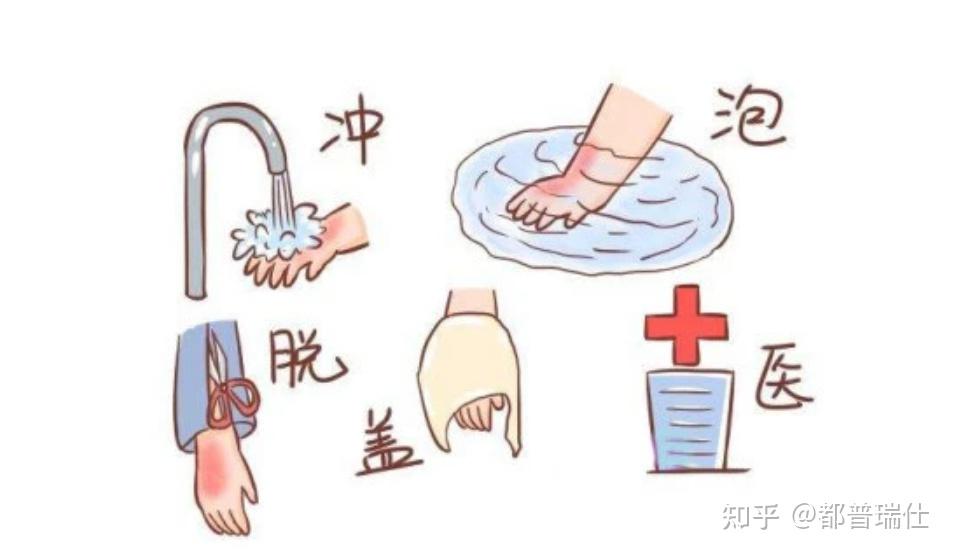 烧烫伤处理 的四个常见错误 - 知乎