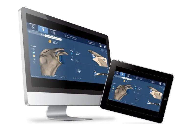 获批FDA！史赛克Mako Shoulder上市！ - 知乎