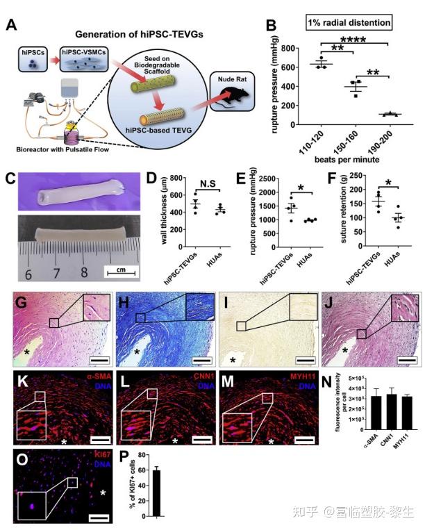 PGA Biofelt植入级无纺布人类 iPSC 制成的具有高机械强度的组织工程血管移植物 - 知乎