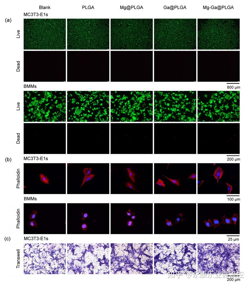 天津环境医学与作业医学研究所王新兴&天津医科大学口腔医院陈刚：镁镓共负载微球通过促进成骨和抗菌作用加速骨修复 - 知乎