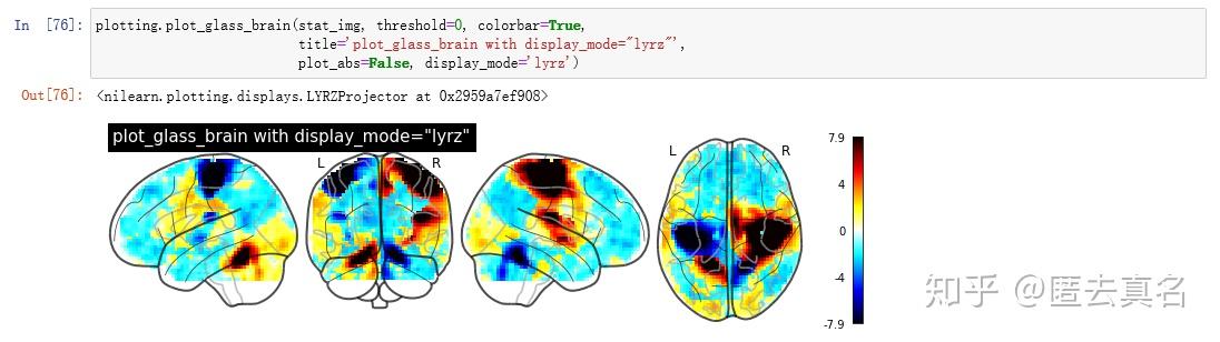 nilearn 笔记（6） - 知乎