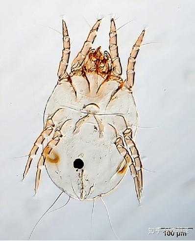 机翻|尘螨 - 知乎