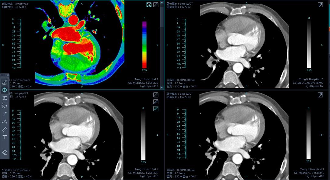 C++ DirectX11渲染到Qt界面 - 知乎