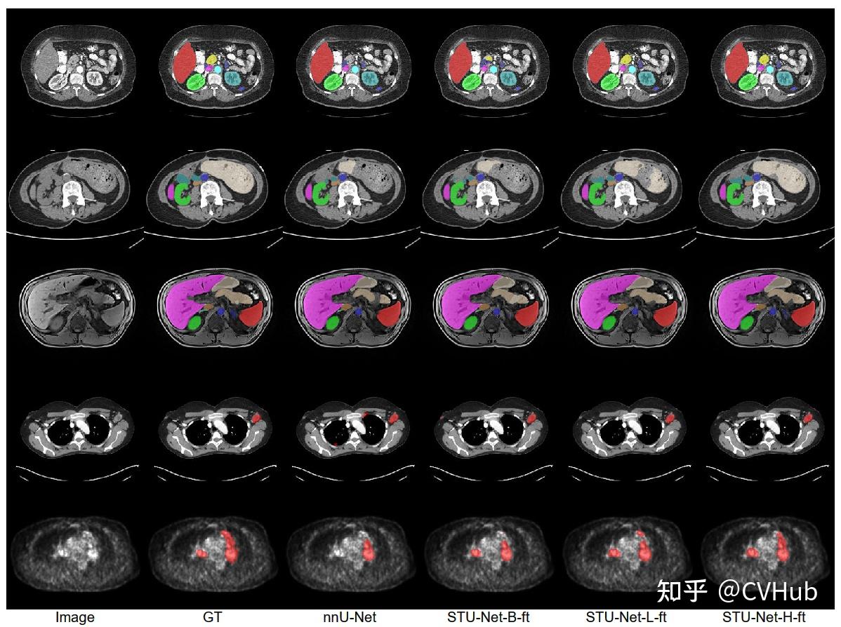 unet图像分割效果不理想，有什么改进方法？ - 知乎