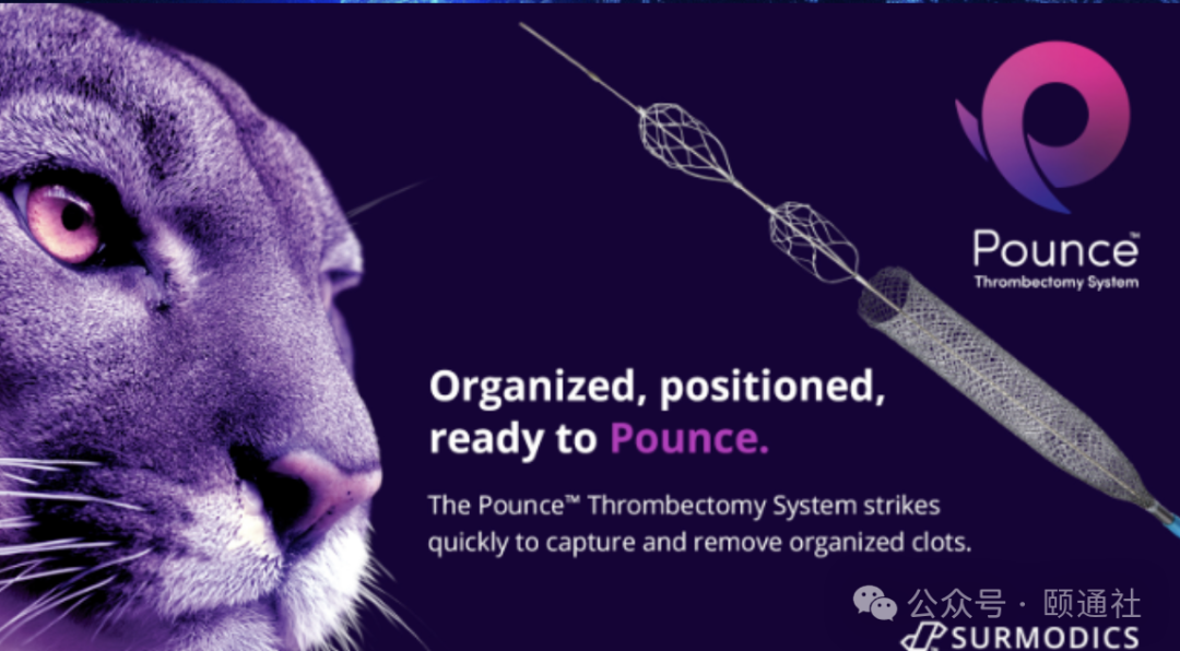 告别溶栓依赖！Pounce XL取栓支架，填补大血管空白 - 知乎