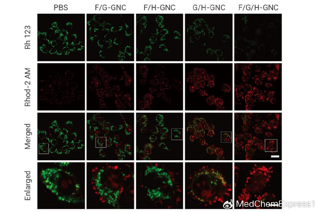 钙信号研究必备：常见钙离子检测工具及其应用_MedChemExpress(MCE 中国) - 知乎