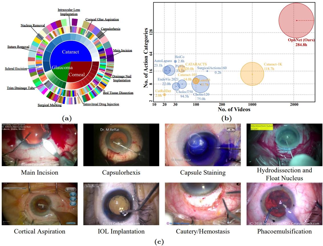 OphNet2024 挑战赛数据集介绍 - 知乎