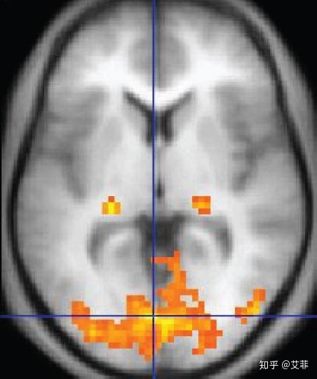 脑科学研究方法（三）功能性核磁共振 - 知乎