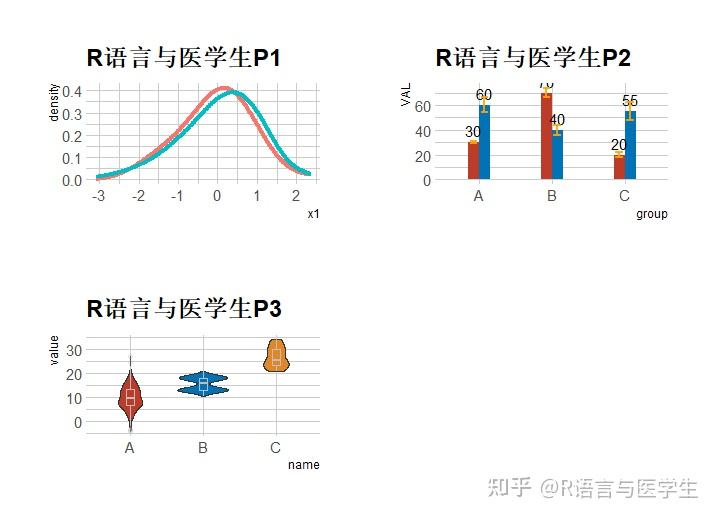 如何用r语言在一个背景下画多个图形? - 知乎
