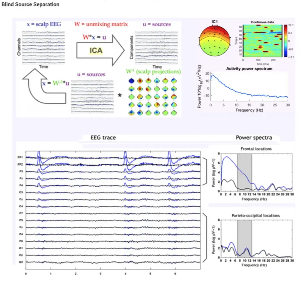 常见的EEG伪影及处理方案 - 知乎