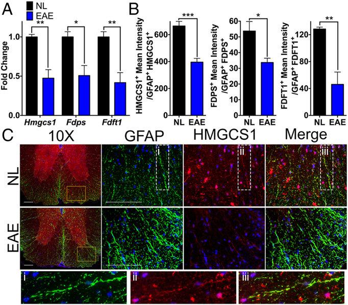 神经管畸形科普 - 知乎
