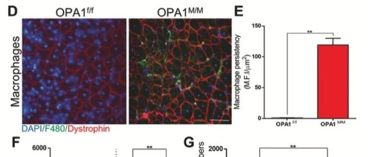 CDD丨OPA1 通过 p65 信号驱动巨噬细胞代谢和功能承诺 - 知乎