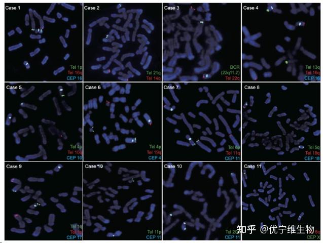 OGM技术临床最新进展发布，看看国内专家怎么说 - 知乎