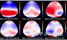 Neuroscan脑电EEG分析教程-Scan4.5 - 知乎
