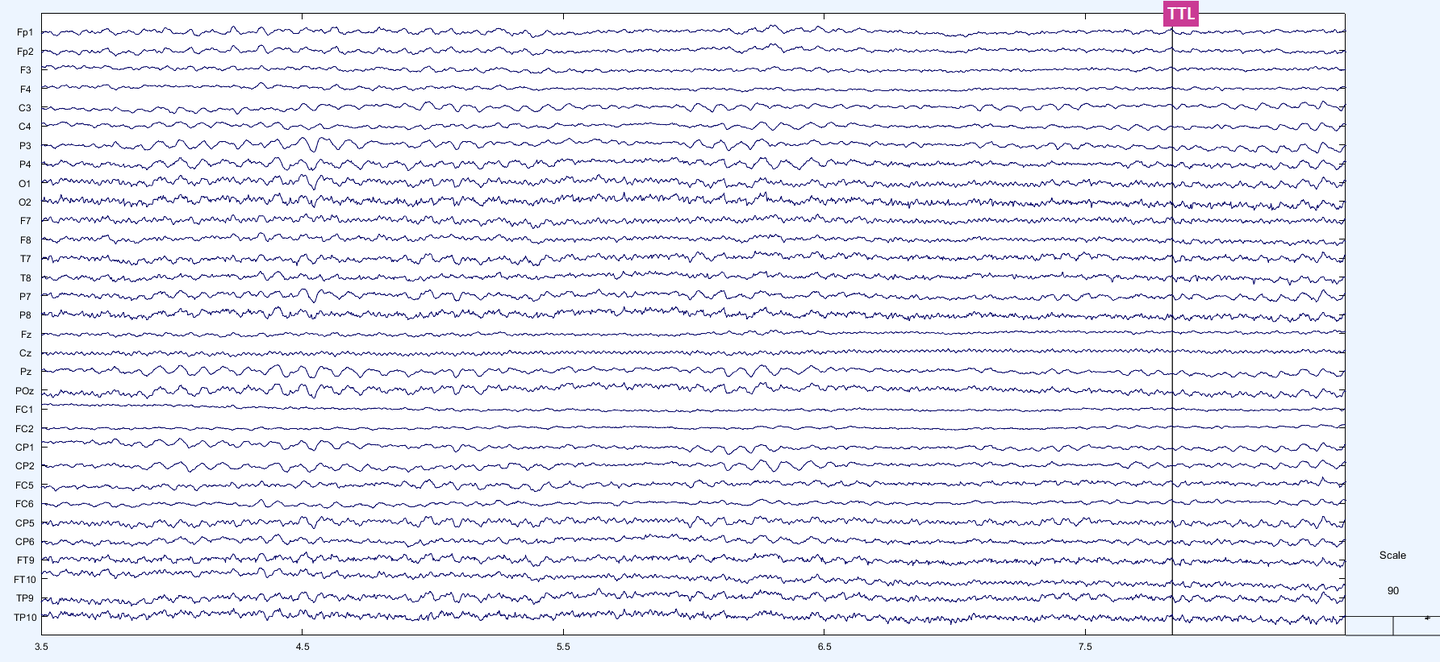 连接PsychoPy与EEG/fNIRS；打MARKER! - 知乎