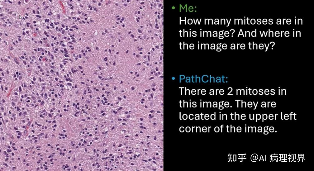 深度洞察｜ 病理基础大模型的前世今生（下） - 知乎