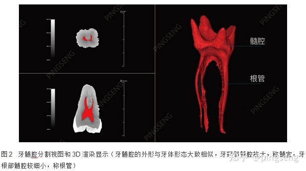 Micro CT在齿科研究中的应用 - 知乎