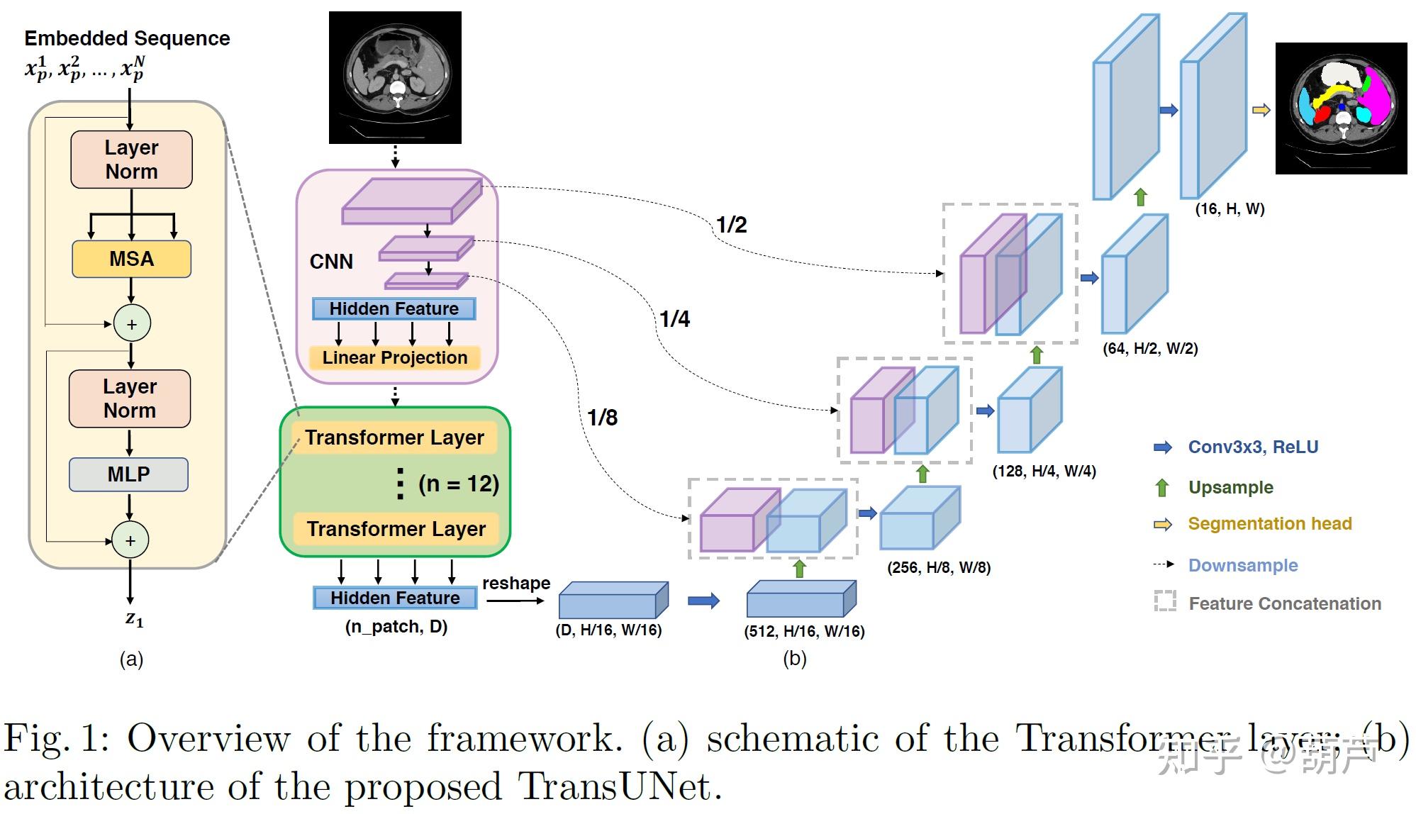 TransUNet: Transformers Make StrongEncoders for Medical Image Segmentation解读 - 知乎