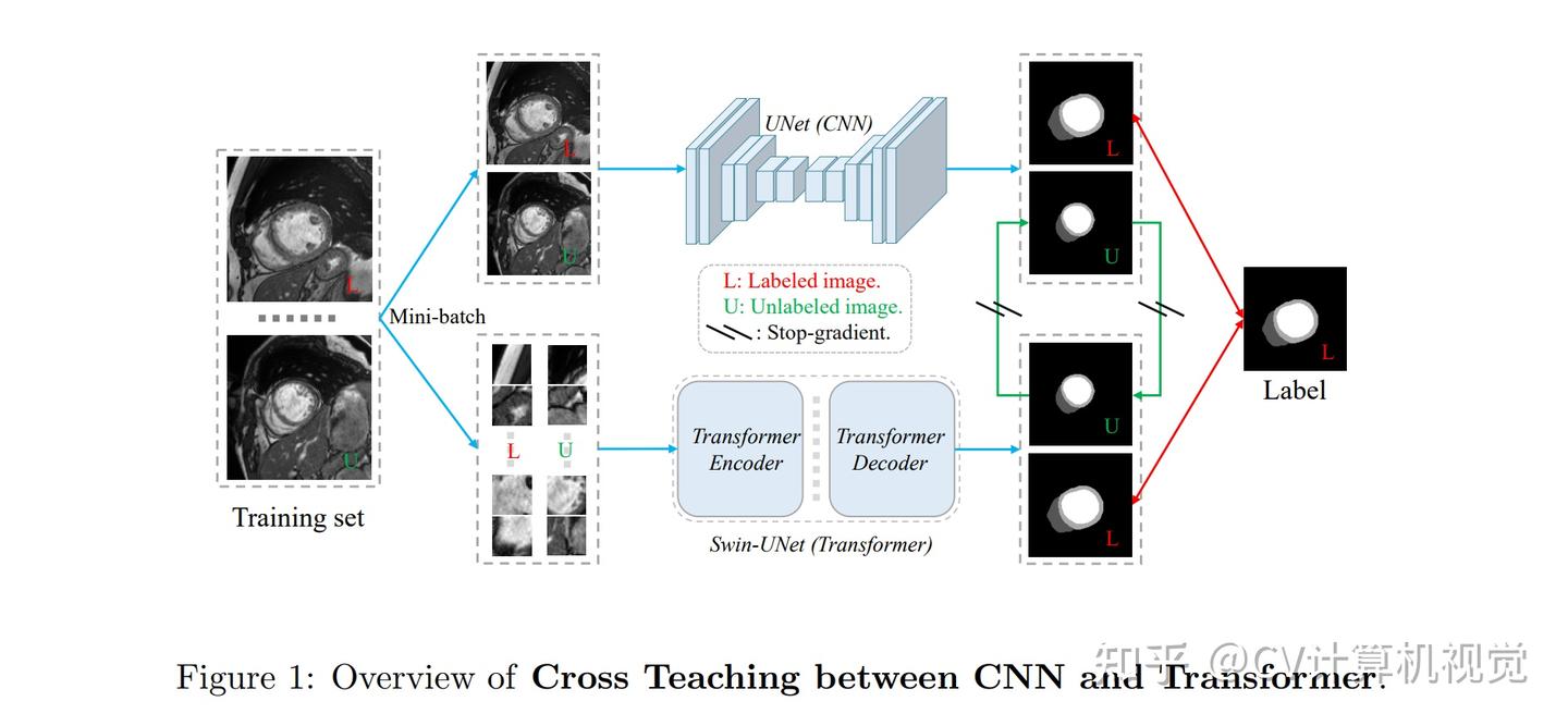 基于Transformer的医学图像分割15篇论文及开源代码 - 知乎
