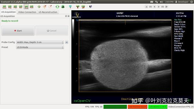 开源科学工程技术软件介绍65 – 用于图像引导治疗的研究平台CustusX - 知乎