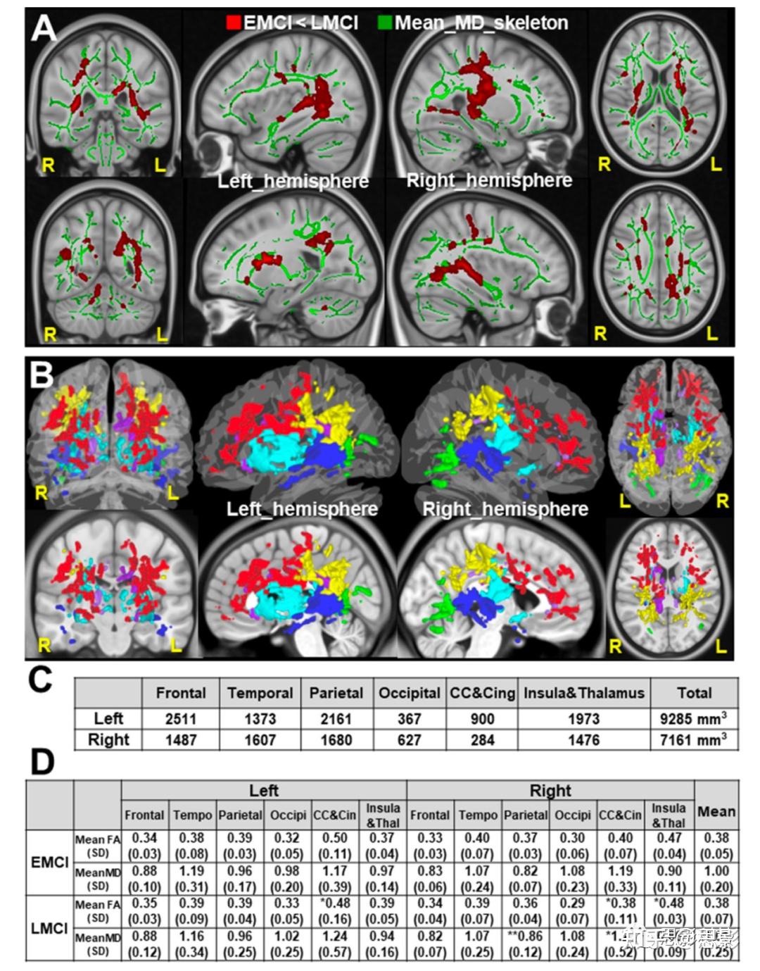 寻找使用多模态MRI数据分类轻度认知障碍（MCI）亚型的最佳机器学习模型 - 知乎