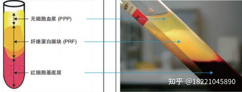 PPP，PRP、PRF都是什么，有什么区别？ - 知乎